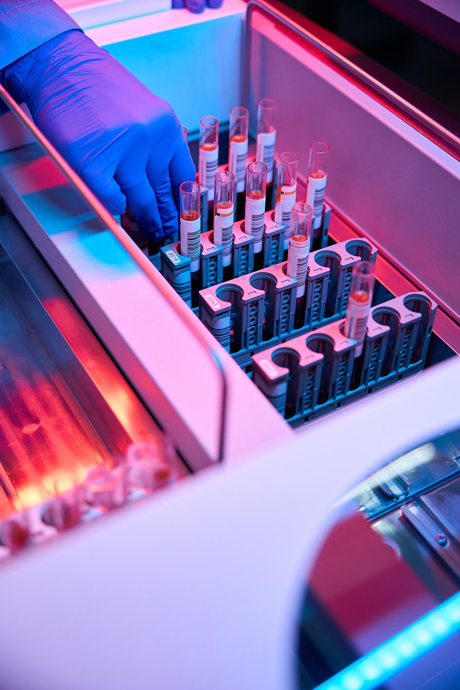 Market Access for IVD Tests in Europe: England, France, Germany, Italy ...