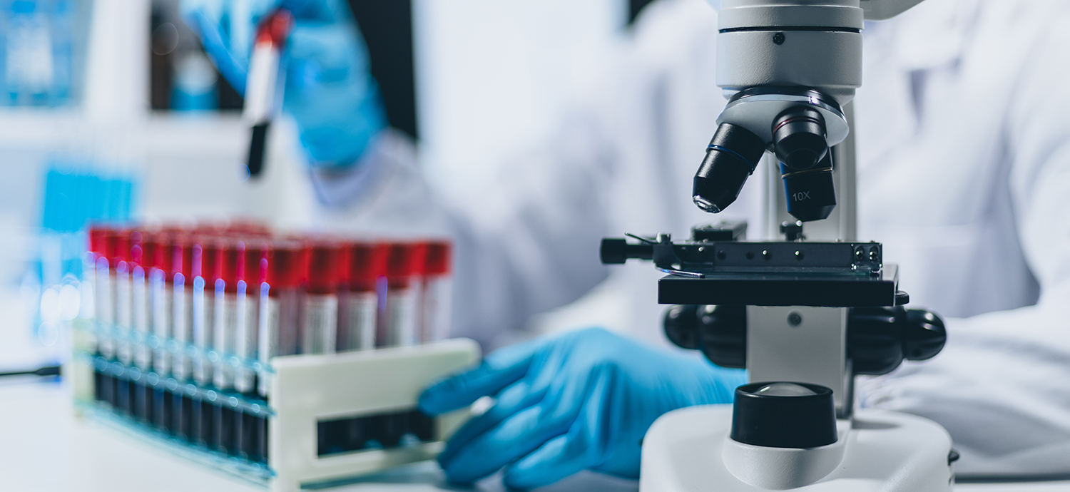 Market Access for IVD Tests in Europe: England, France, Germany, Italy ...